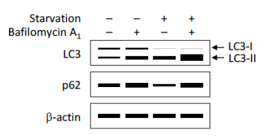 关于『细胞自噬』，看这一篇就够了！ - 哔哩哔哩