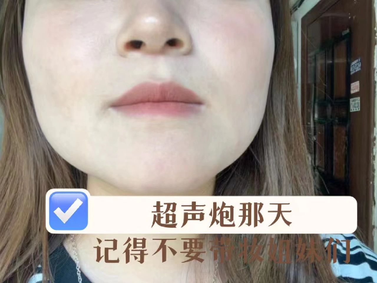 超声炮效果怎么样?超声炮做一次能维持多久 哔哩哔哩