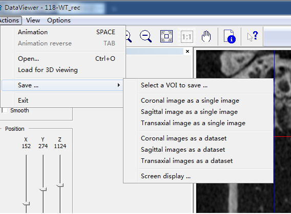 micro-CT重建后步骤分析 - 哔哩哔哩