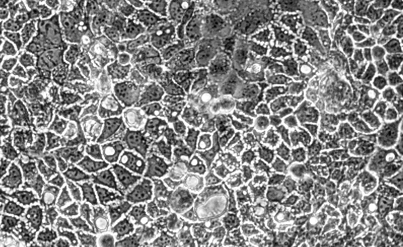人结直肠腺癌细胞(Caco-2)培养要点 - 哔哩哔哩