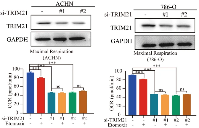 项目文章J Exp Clin Cancer Res（IF 12.6）|脂质组学助力解密TRIM21抑制RCC脂质代谢过 - 哔哩哔哩