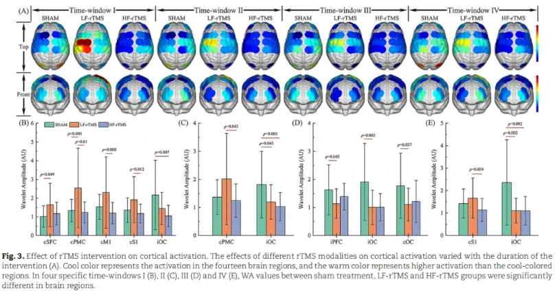 【慧创近红外】VR EEG TMS tDCS DBS taVNS (多模态联用）研究集锦 - 哔哩哔哩