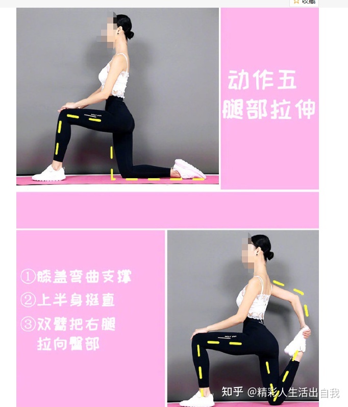 O型腿怎么纠正 O型腿图片 文坚 O型腿纠正方法 哔哩哔哩