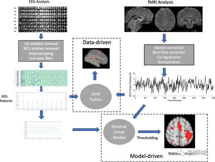 多模态神经成像之EEG-fMRI同步 - 哔哩哔哩