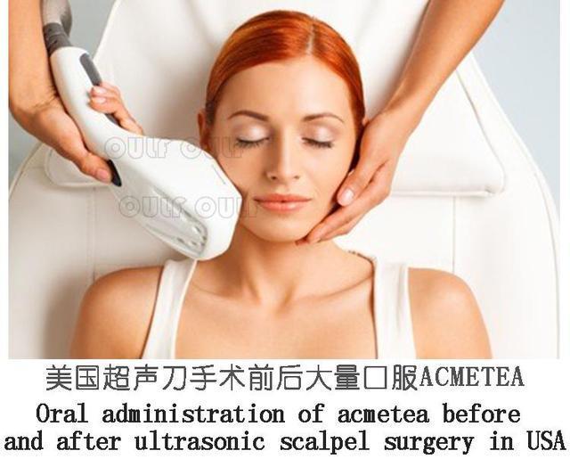 逆龄美雕和超声刀区别，吃ACMETEA【超刀美盾】还是【提线盾】？ - 哔哩哔哩