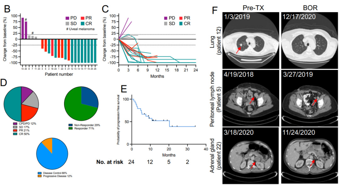 ATRA和PD-1单抗联合用药，提高PD-1效力 - 哔哩哔哩