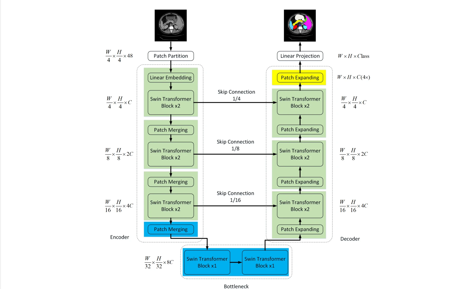 Swin-Unet与Unet的菜鸡分析与复现 - 哔哩哔哩