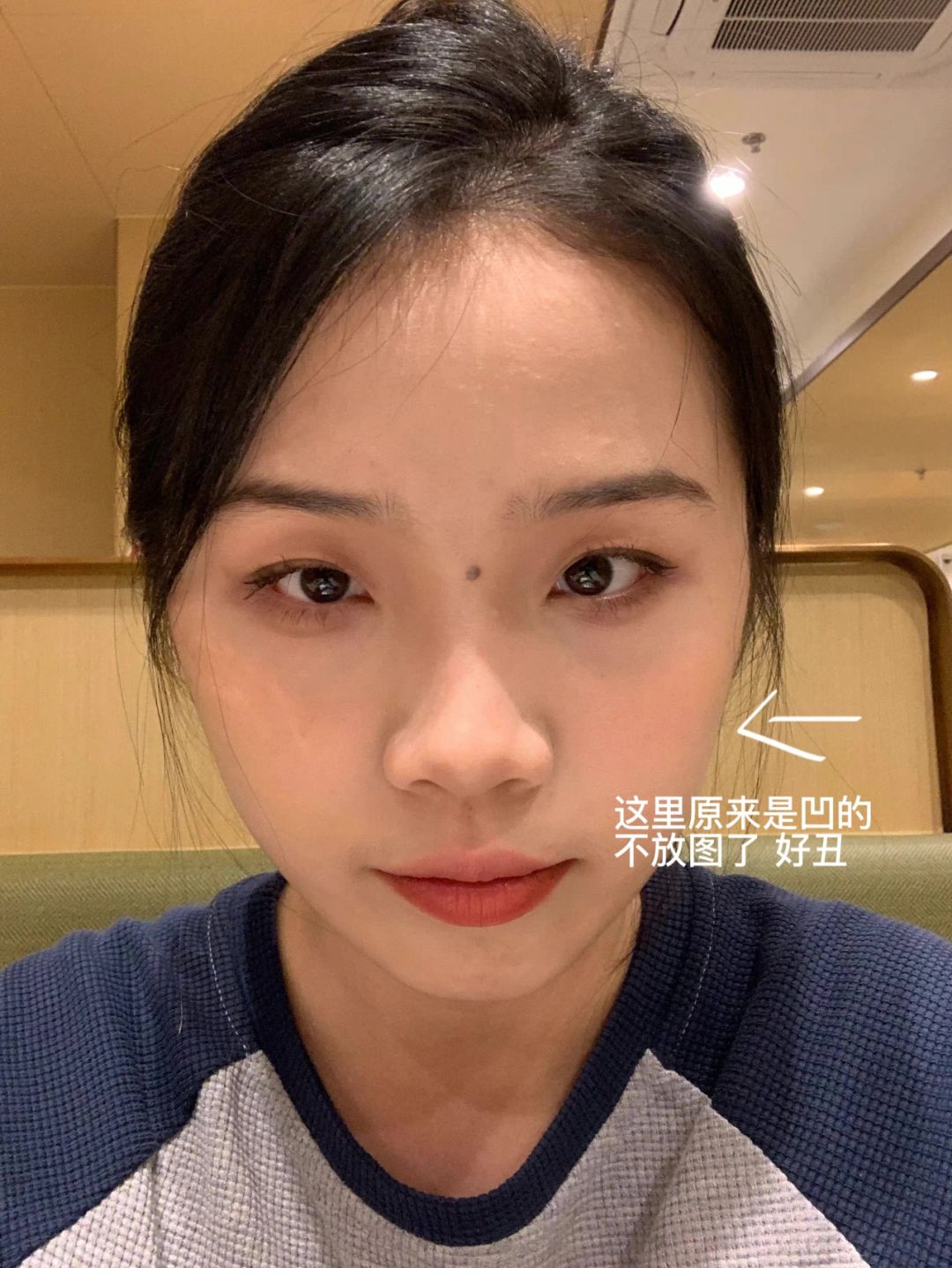 超声炮的效果怎么样,做超声炮有用吗 哔哩哔哩