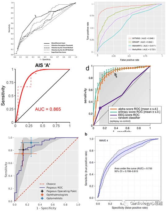 ROC曲线，套路全解析（一） - 哔哩哔哩