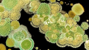 scp－532－霜菌 - 哔哩哔哩