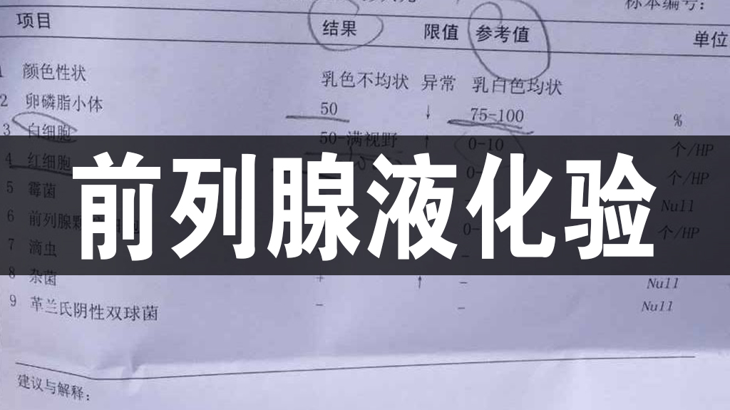 前列腺常规检查怎么做？才能准确判断症状结果1 哔哩哔哩