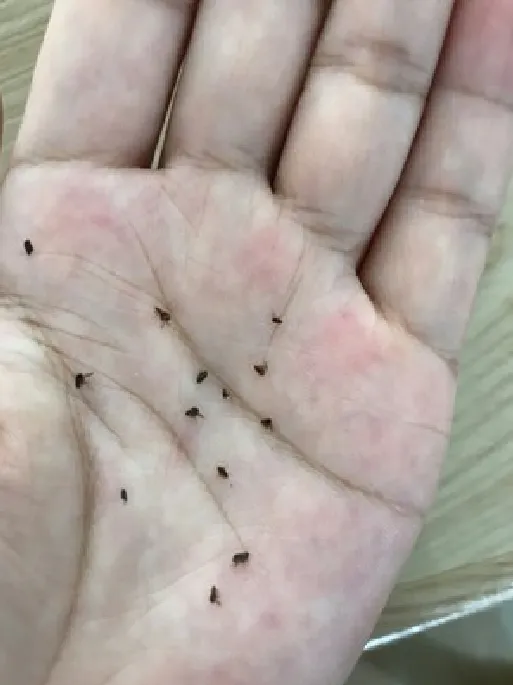 被跳蚤咬的家都不想住了,有什么办法灭了它们? 哔哩哔哩