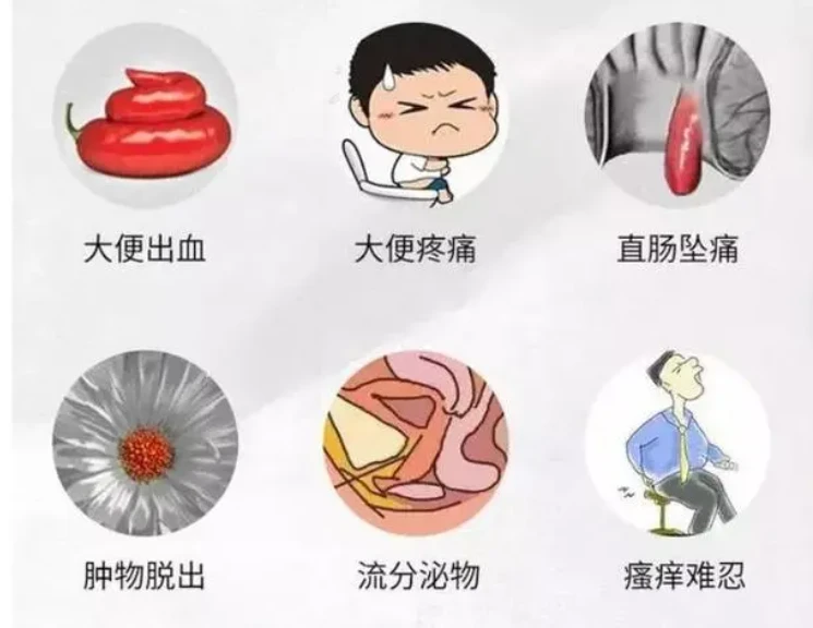 痔疮肉球脱出疼痛难忍怎么办?日常做到这几点! 哔哩哔哩