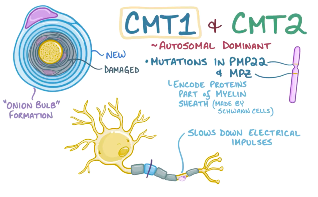 【Osmosis医学】腓骨肌萎缩症 Charcot-Marie-Tooth Disease - 哔哩哔哩