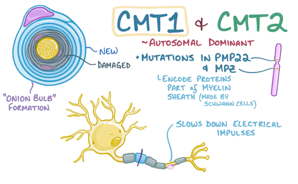 【Osmosis医学】腓骨肌萎缩症 Charcot-Marie-Tooth Disease - 哔哩哔哩