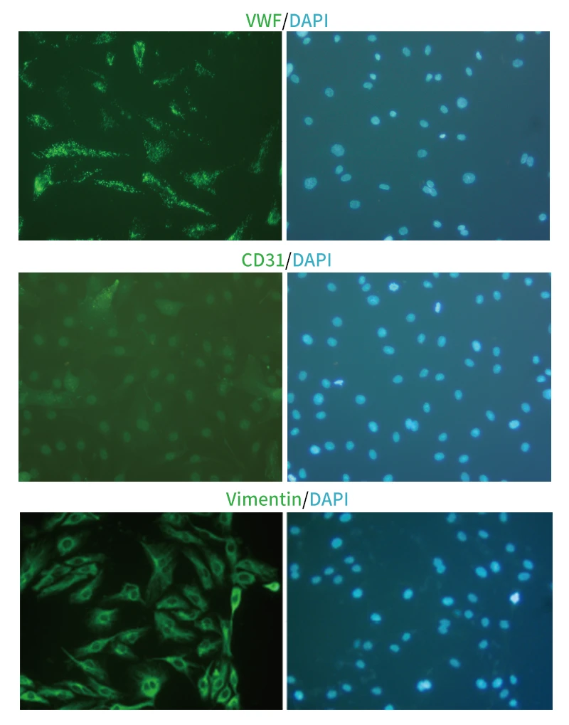 HUVEC 血管形成实验（补充成长视频部分细节） - 哔哩哔哩