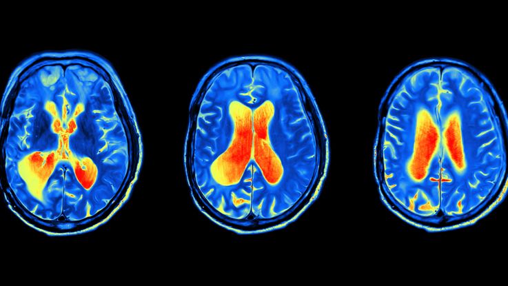 课堂笔记：fMRI实验设计 - 哔哩哔哩