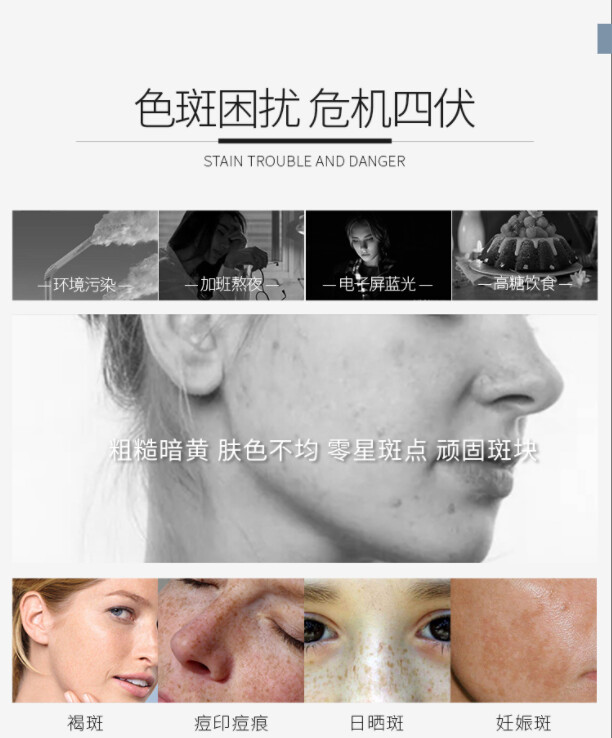 真正有效的美白祛斑产品，国家认可的祛斑品牌值得用！ 哔哩哔哩