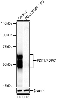 文献解读 | 郭剑平研究组Nature Communications揭示S6K1激酶新靶点PDK1 - 哔哩哔哩