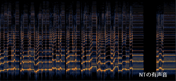 【初音未来NT的真面目】从「音质不尽如人意」出发探究Crypton社的意图【授权译制】 - 哔哩哔哩