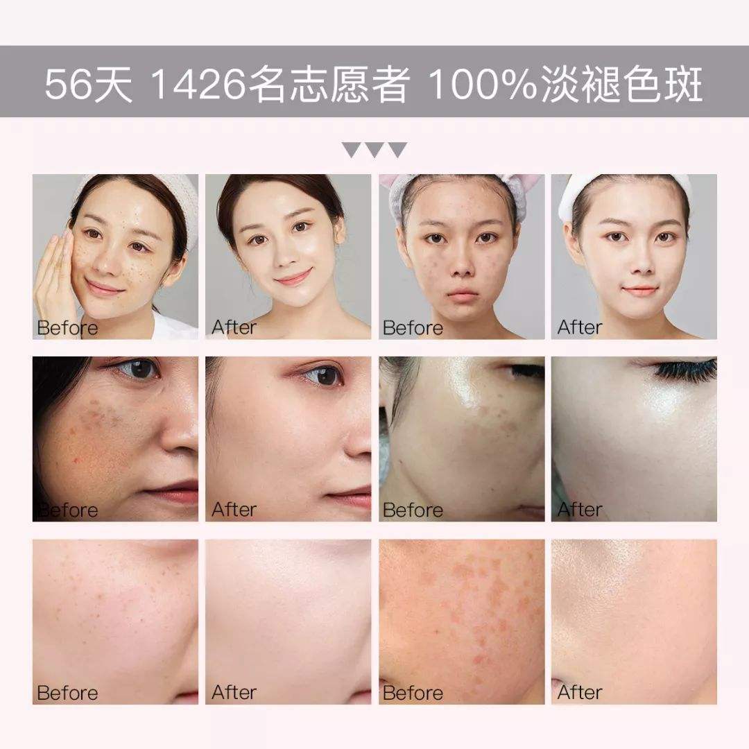 淡斑效果好的护肤品，斑点不再困扰肌肤啦！ 哔哩哔哩