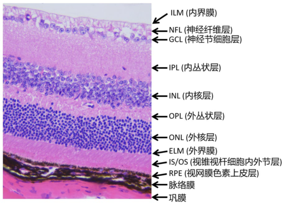 AAV基因治疗在眼科疾病研究中的应用及常见注射方式 - 哔哩哔哩