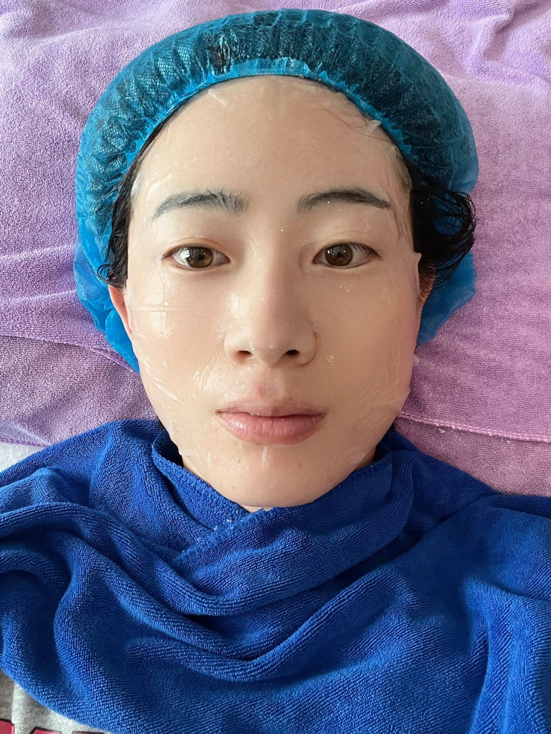 超声炮对法令纹有效果吗,超声炮多久有效果 哔哩哔哩