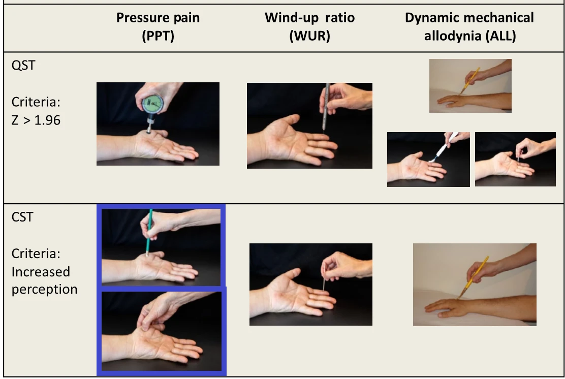 慢性疼痛中的定量感觉测试从研究到临床 - 哔哩哔哩