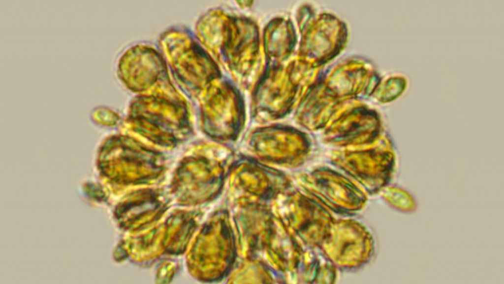 色藻界E04——黄群藻纲（Synurophyceae） - 哔哩哔哩