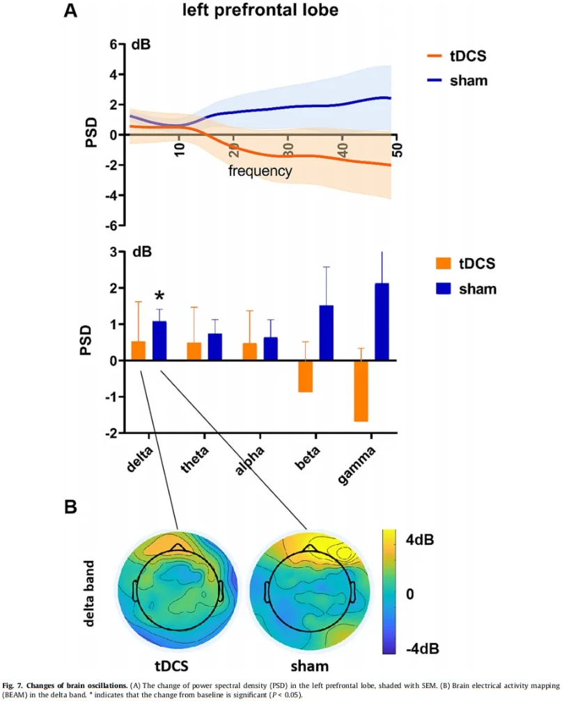 【慧创近红外】VR EEG TMS tDCS DBS taVNS (多模态联用）研究集锦 - 哔哩哔哩