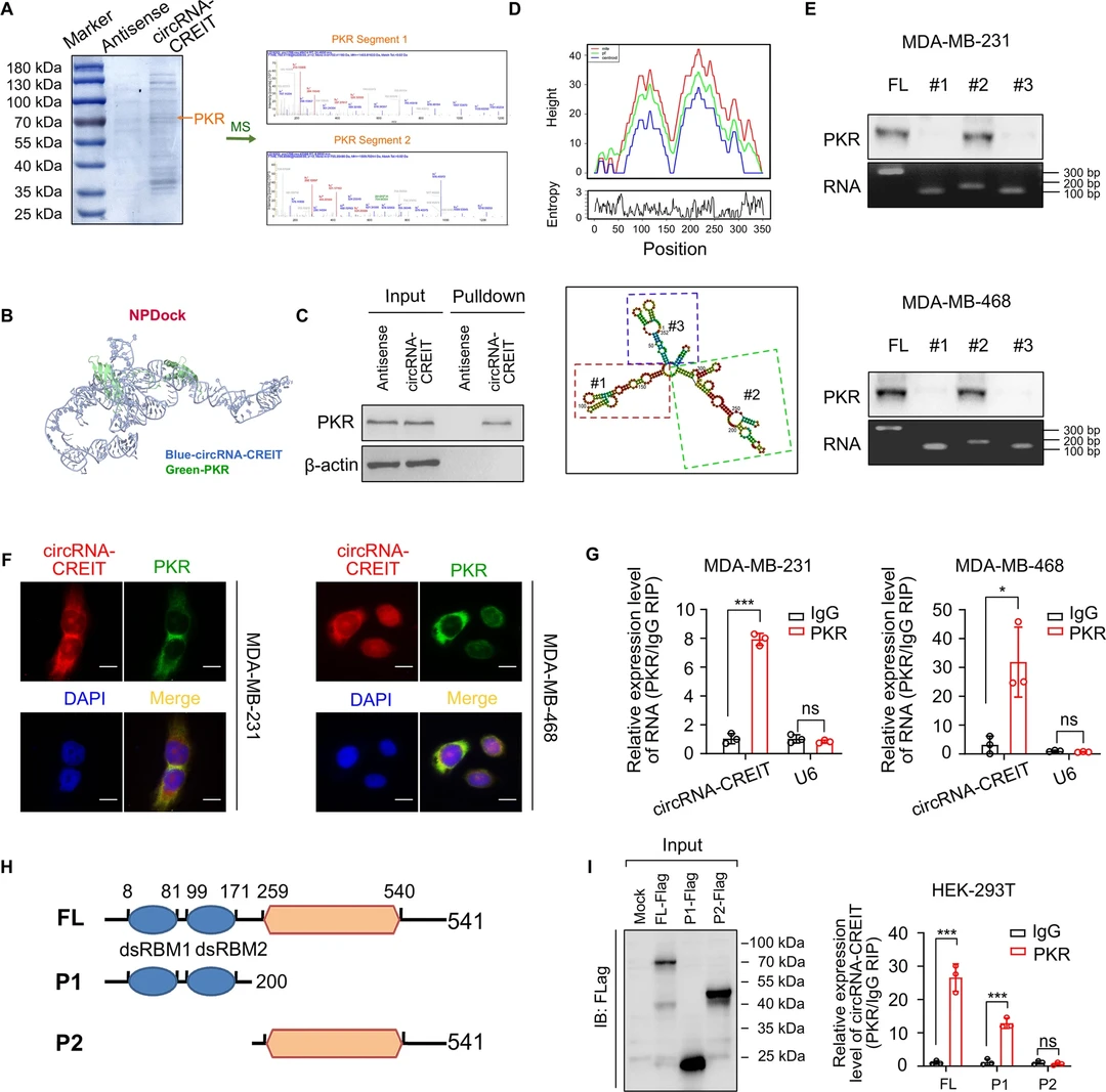J Hematol Oncol | 乳腺癌类器官助力发现对抗三阴性乳腺癌化学耐药性的新策略 - 哔哩哔哩