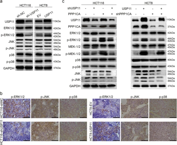 USP11通过PPP1CA介导的ERK/MAPK信号通路激活促进结直肠癌的生长和转移 - 哔哩哔哩