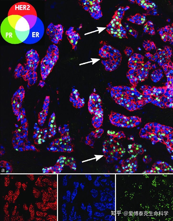 免疫荧光染色 学习笔记 - 哔哩哔哩