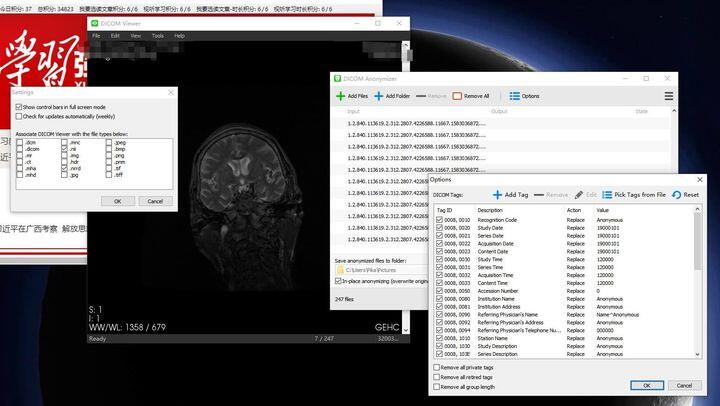 分享八个各有优势的 DICOM 图像阅读和科研处理软件（附 Radiant Viewer 免激活版） - 哔哩哔哩