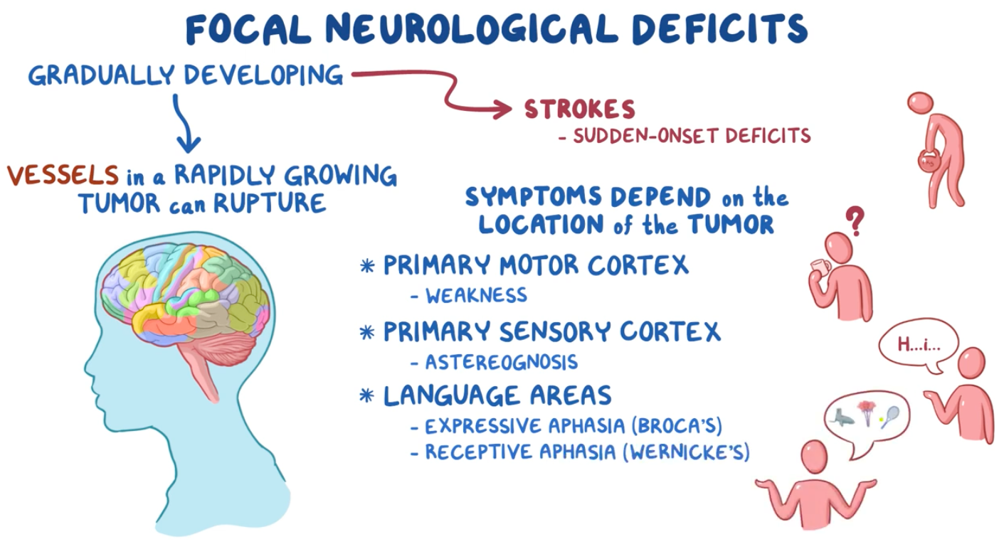 【Osmosis医学】临床推理：脑肿瘤 - 哔哩哔哩