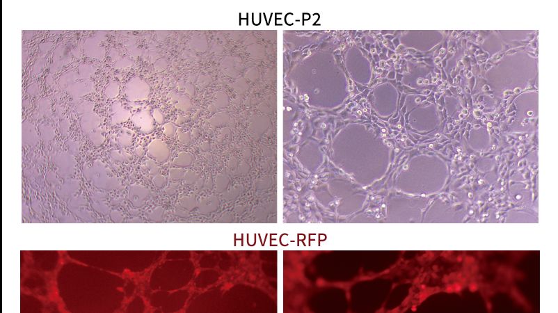 HUVEC 血管形成实验（补充成长视频部分细节） - 哔哩哔哩