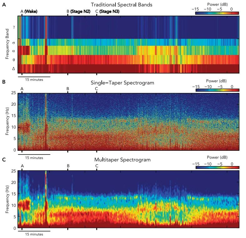 睡眠分期 | Lunion Stage 如何使用频谱图提高睡眠分析效率 - 哔哩哔哩
