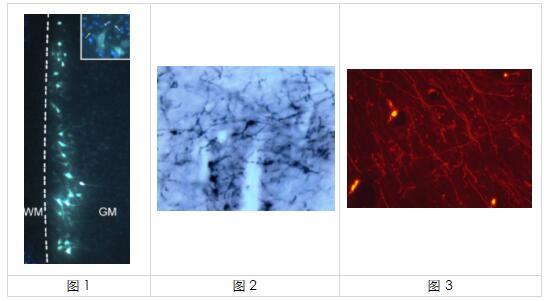 神经元逆行/顺行示踪：艾美捷Fluorochorome方案 - 哔哩哔哩