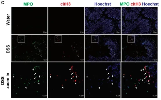 中性粒细胞胞外诱捕网（NETs）：形成、应用、诱导、检测！ - 哔哩哔哩