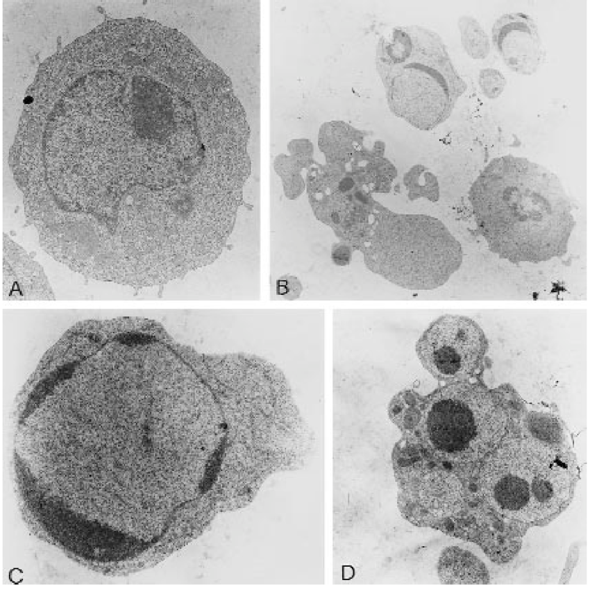 细胞凋亡检测（实验简介,实验目的,实验原理,所需试剂,方法步骤） - 哔哩哔哩