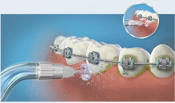 冲牙器十大品牌排行榜：推荐十款2023重磅靠谱品牌 - 哔哩哔哩