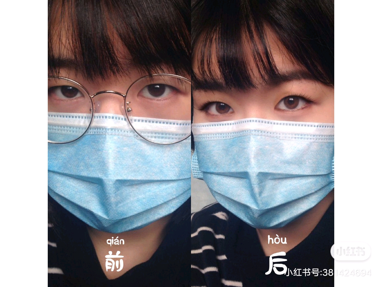 单眼皮内双肿眼泡超实用通勤眼妆口罩眼妆放大消肿提肌 哔哩哔哩