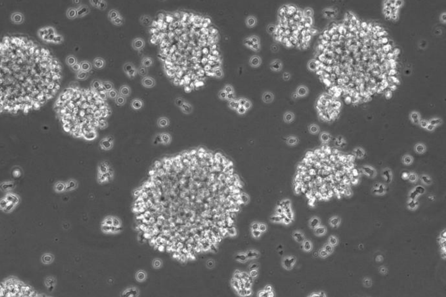 NK-92与NK-92MI培养注意要点 - 哔哩哔哩