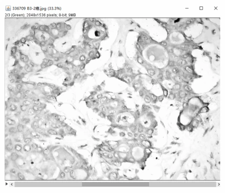 轻松学会，用Image J定量分析免疫组化图！ - 哔哩哔哩