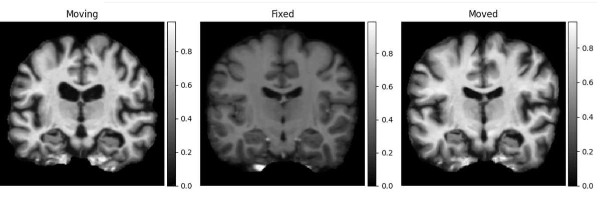 分割图——SynthMorph，零样本学习完成跨模态配准任务 - 哔哩哔哩