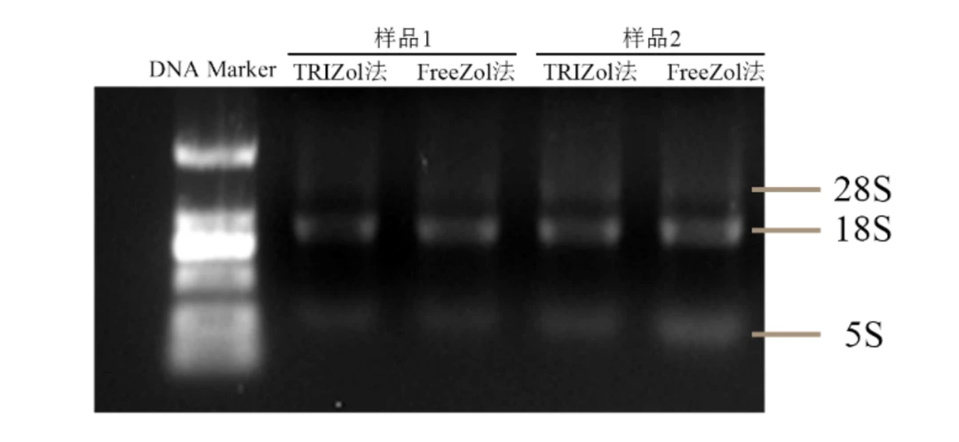 手把手教学——RNA提取的实验步骤&注意事项 - 哔哩哔哩
