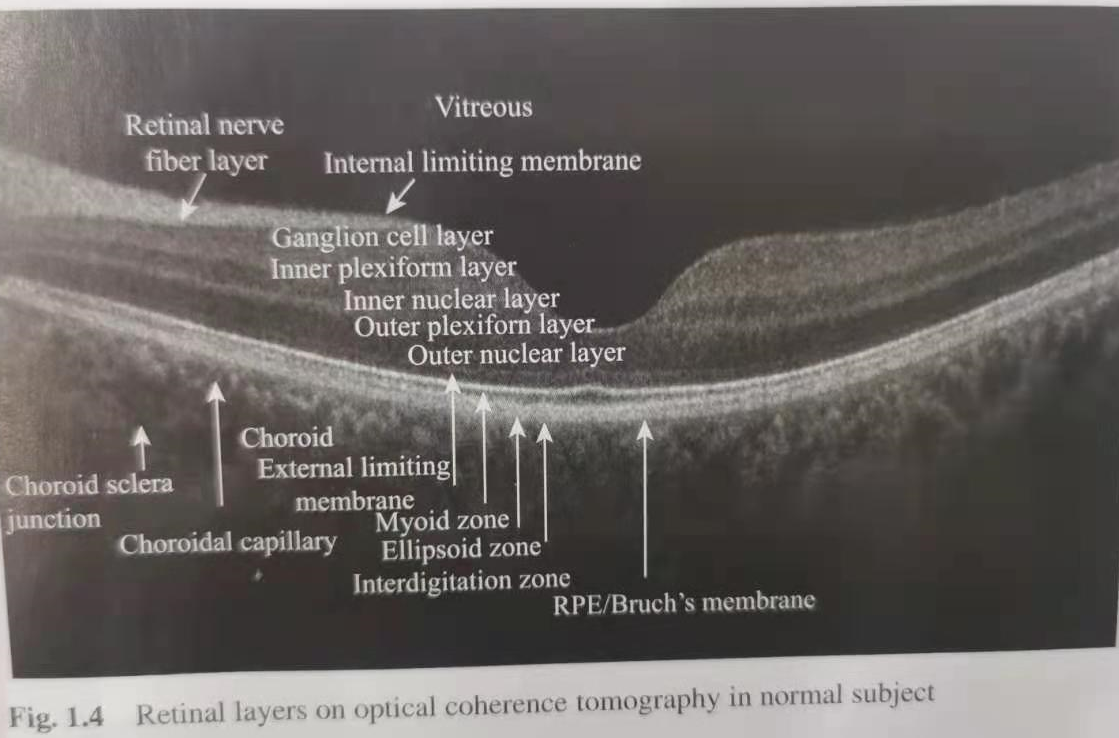 OCT的应用与解读 NOTE（一） - 哔哩哔哩