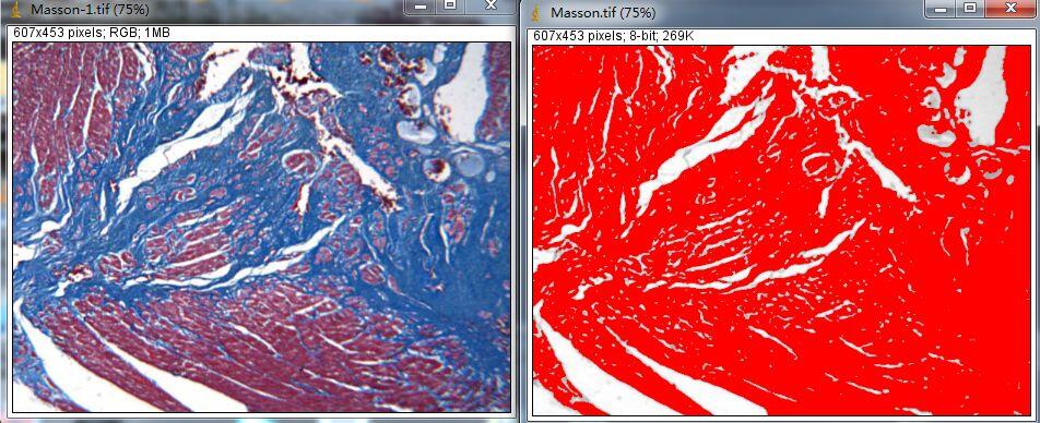绘图干货丨老司机解带你解锁ImageJ面积分析 - 哔哩哔哩