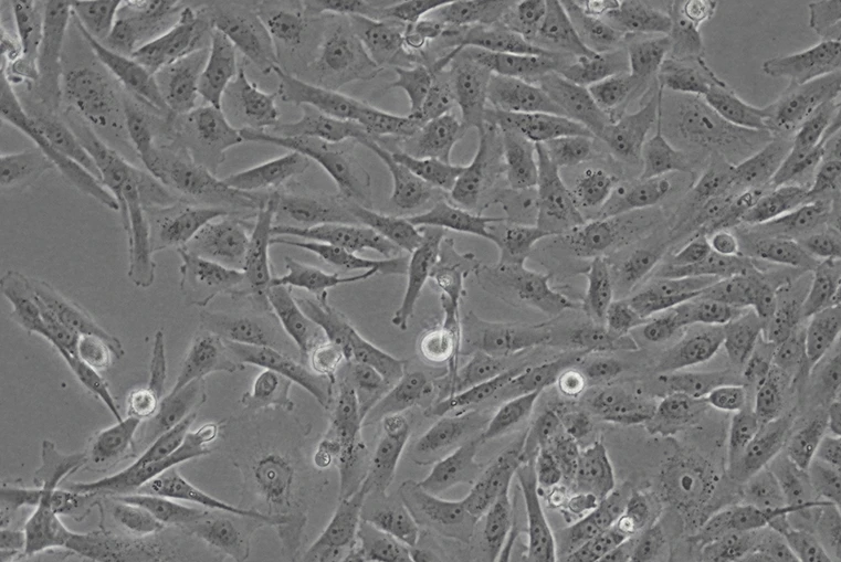 人乳腺癌细胞(MDA-MB-231细胞)培养要点 - 哔哩哔哩