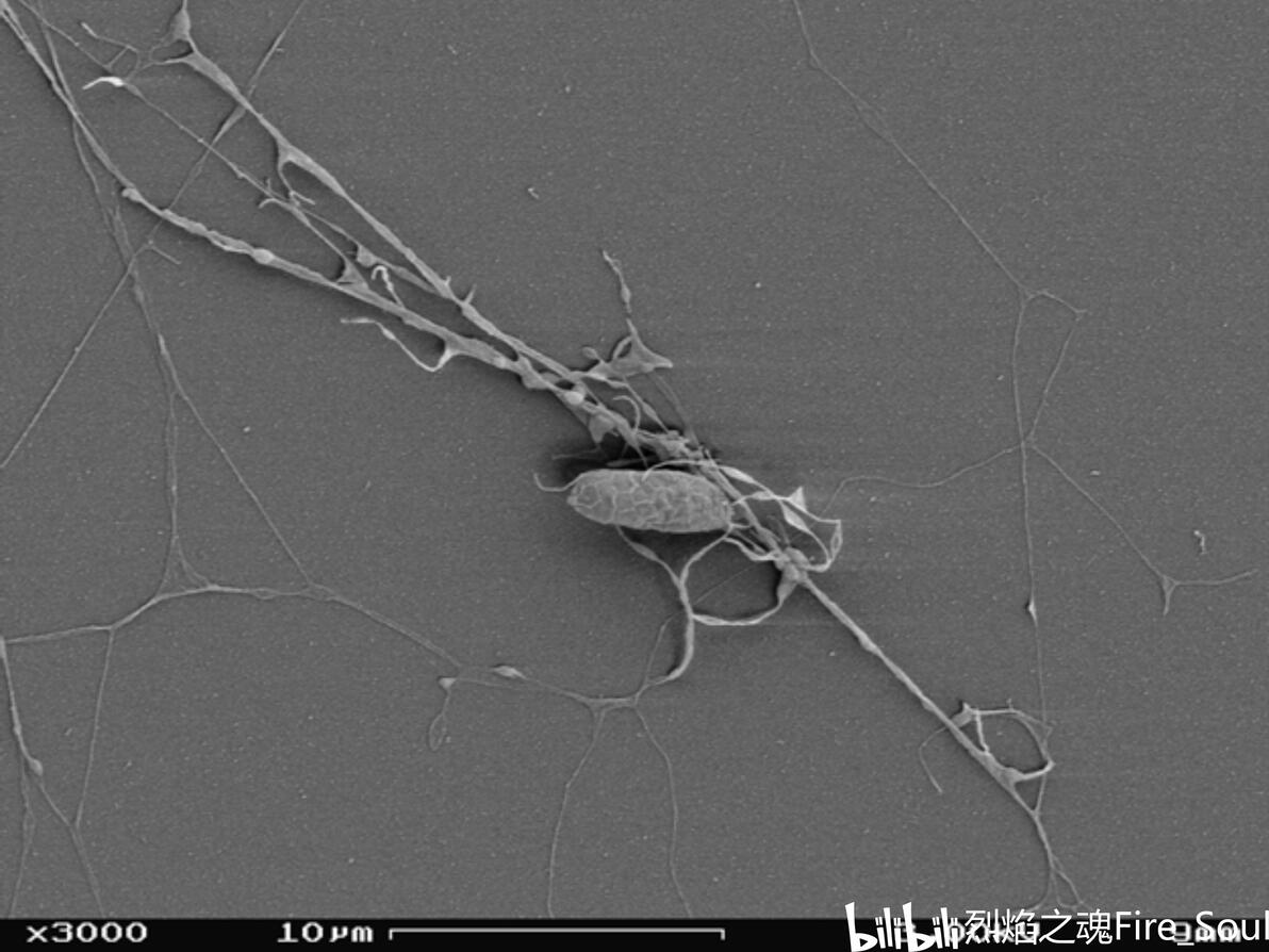 色藻界E02：双环门（Bigyra）和卵菌门（Oomycota） - 哔哩哔哩